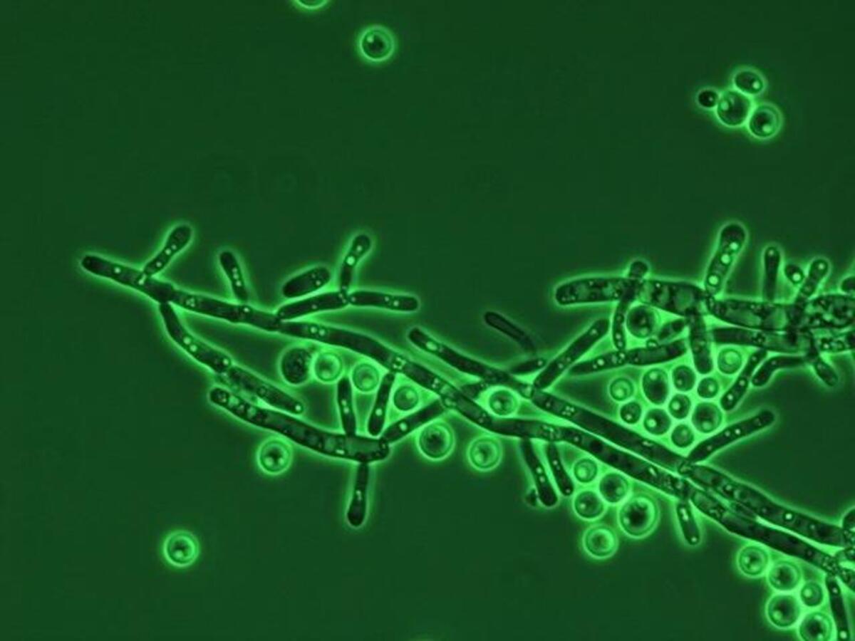 Beetle-dwelling yeast holds promise for biofuel production | Great ...