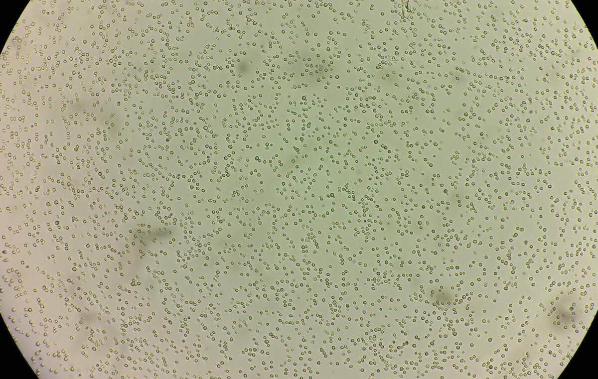 Landmark yeast study provides framework for understanding biodiversity ...